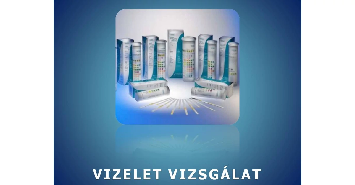 Vizelet vizsgálat